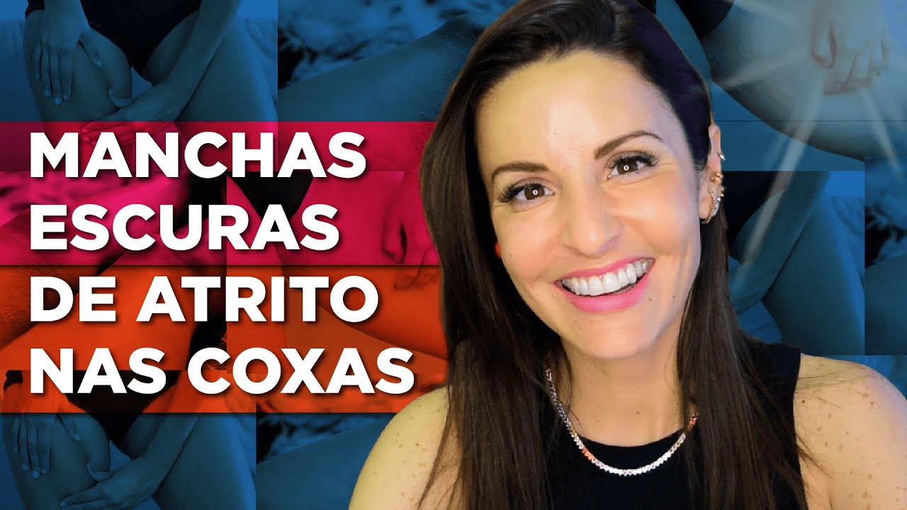 Como CLAREAR MANCHAS ESCURAS nas COXAS, AXILAS, VIRILHAS - YouTube