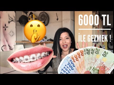 6000 TL İLE GEZMEK | DİŞ TELİ TEDAVİSİ TÜM GERÇEKLER