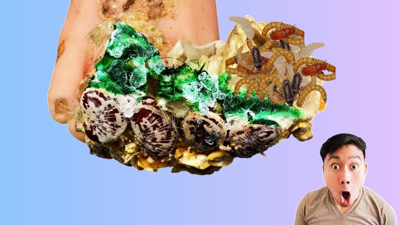 Super curly toenails Onychomycosis Is Very Hard, Perfect Trimming ...