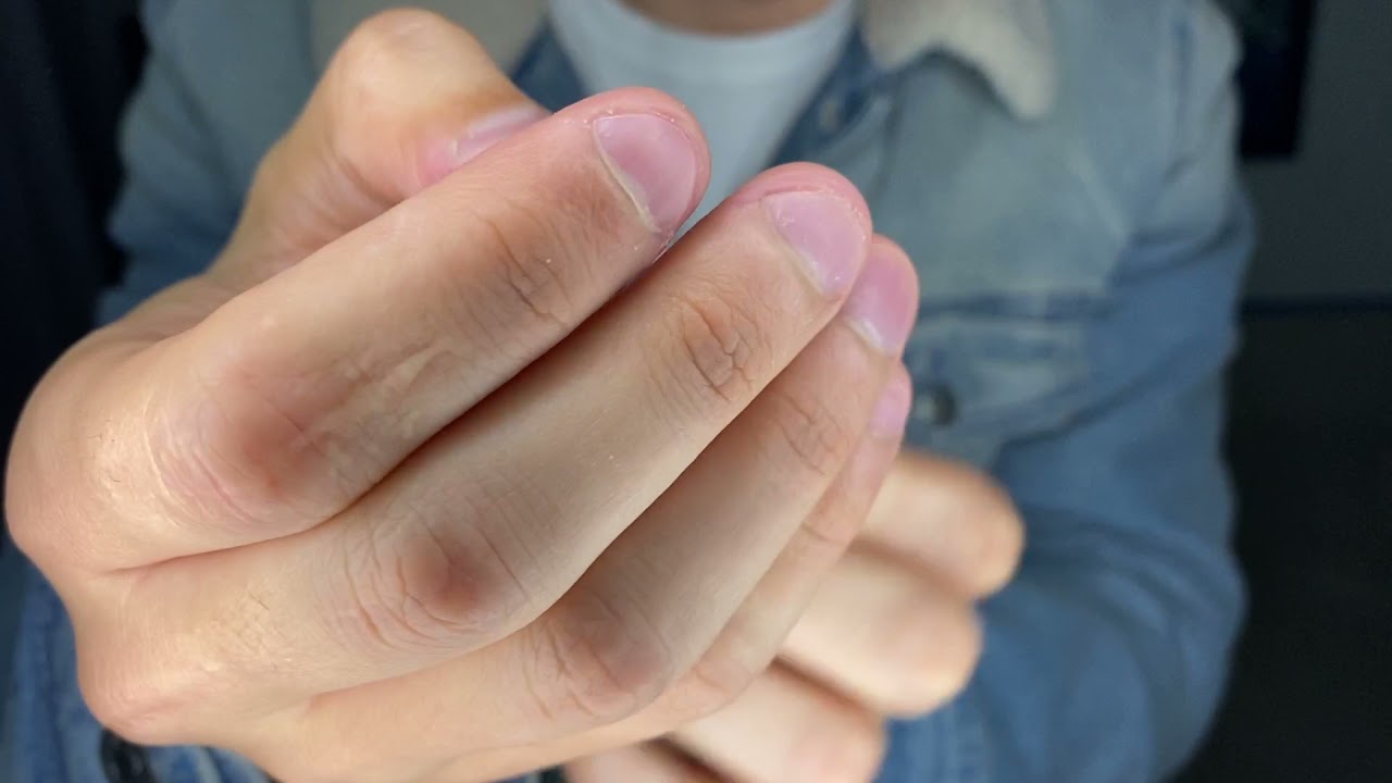 ASMR | AMAZING Finger Cracking/Popping | No Talking - YouTube