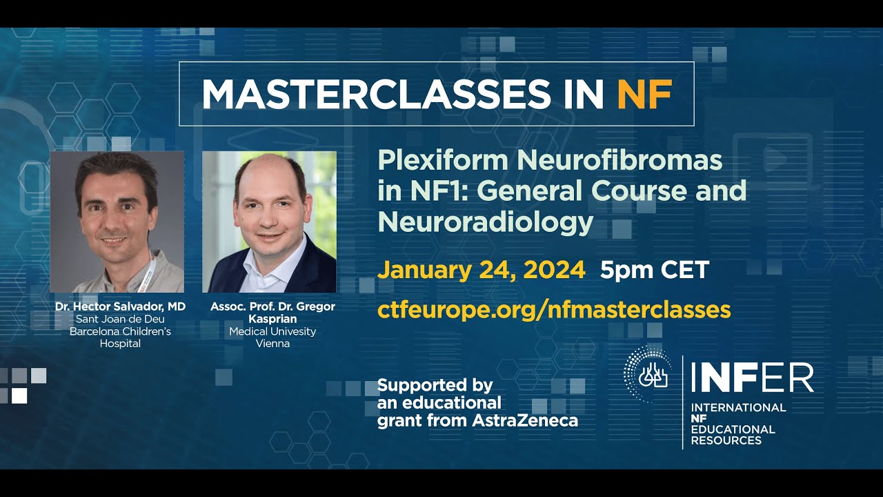 18- Plexiform Neurofibromas NF1 (part1 of 2) (EN) - YouTube