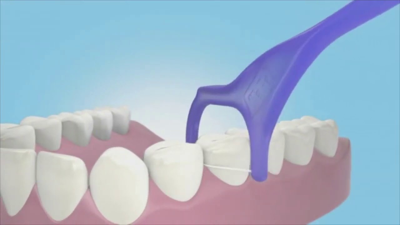 Forcella tendifilo - Faggian Clinic - YouTube