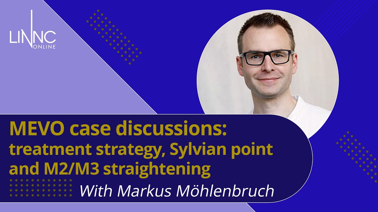 MEVO case discussions: treatment strategy, Sylvian point and M2/M3 ...