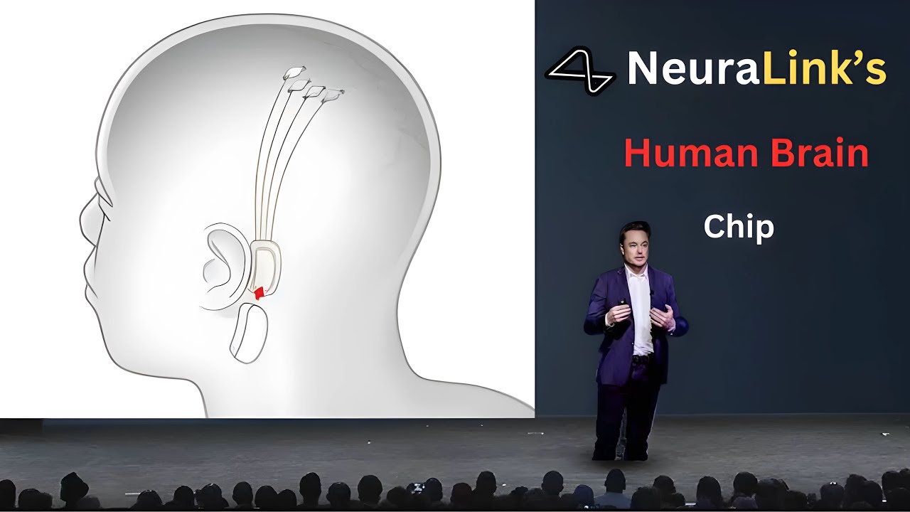 Neuralink's Human Brain Chip | Elon Musk #elonmusk #ai #neurolink - YouTube