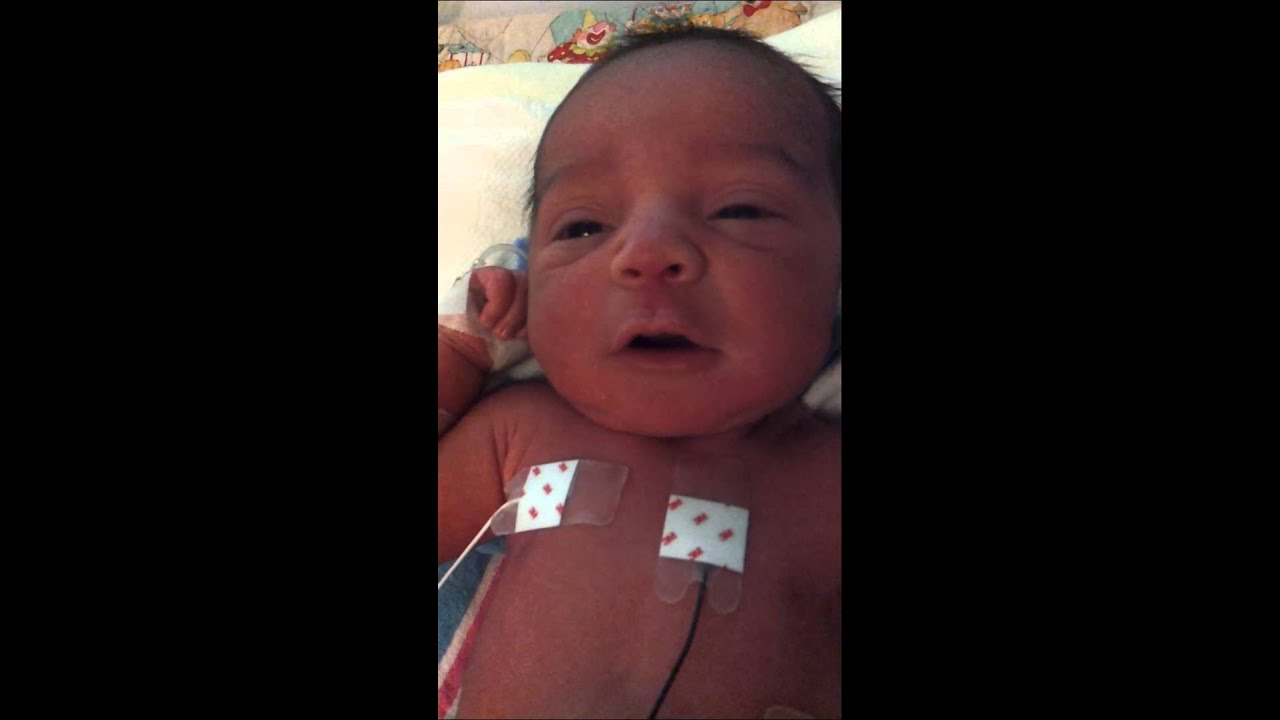 33 week old preemie - YouTube