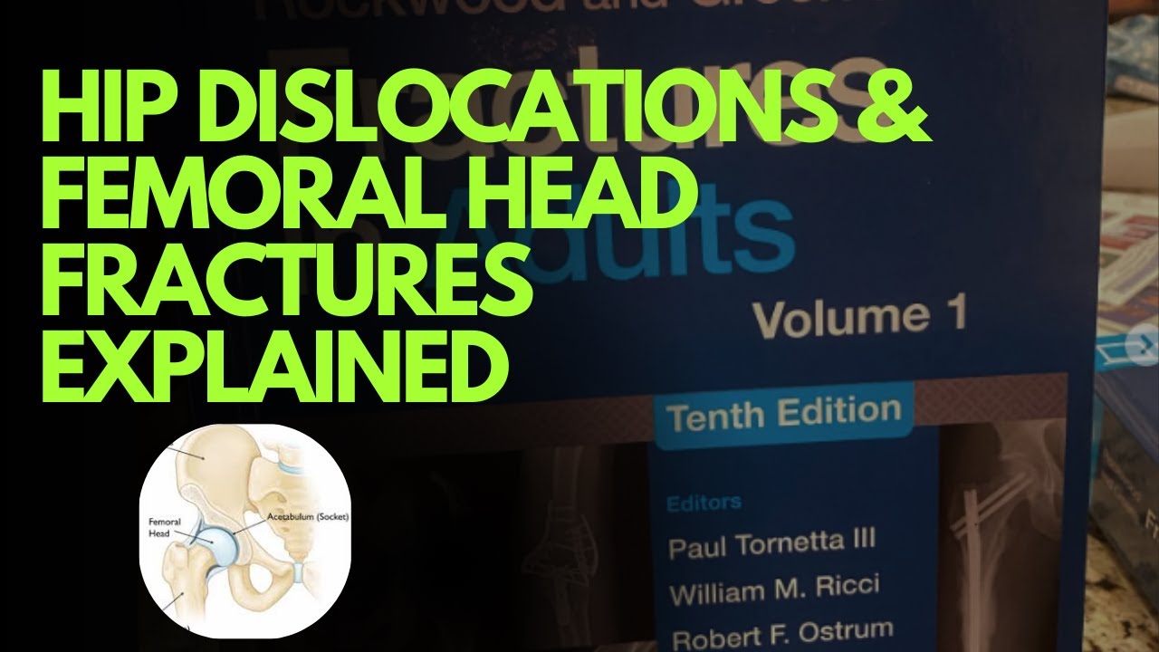 Hip Dislocations and Femoral Head Fractures Explained | Rockwood - YouTube