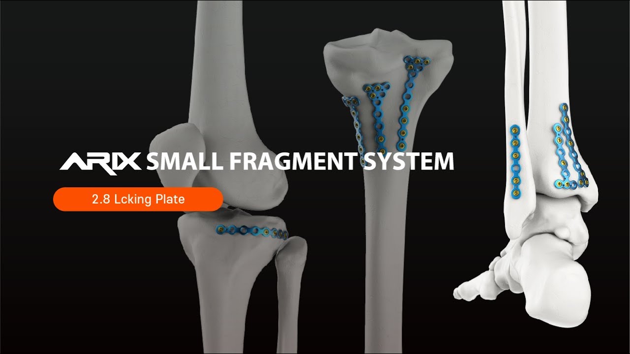 [ARIX OS] Small Fragment System - YouTube