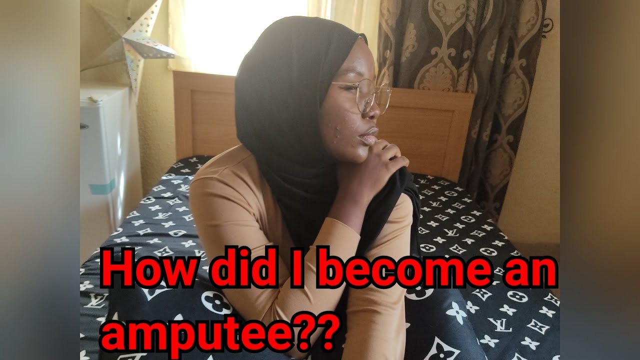 HOW I BECAME AN AMPUTEE.// MY TRUE LIFE STORY. - YouTube