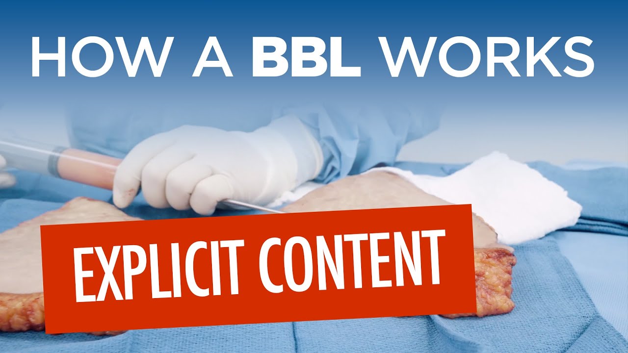 How a BBL Works - YouTube