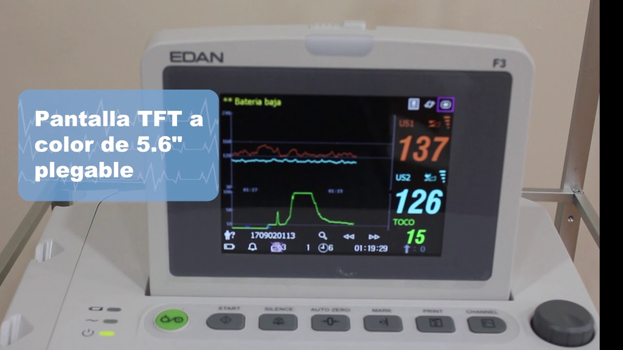 Monitor Fetal F3 - YouTube