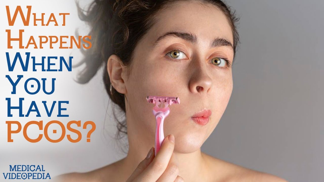 Understanding The Complexities Of Polycystic Ovary Syndrome Youtube