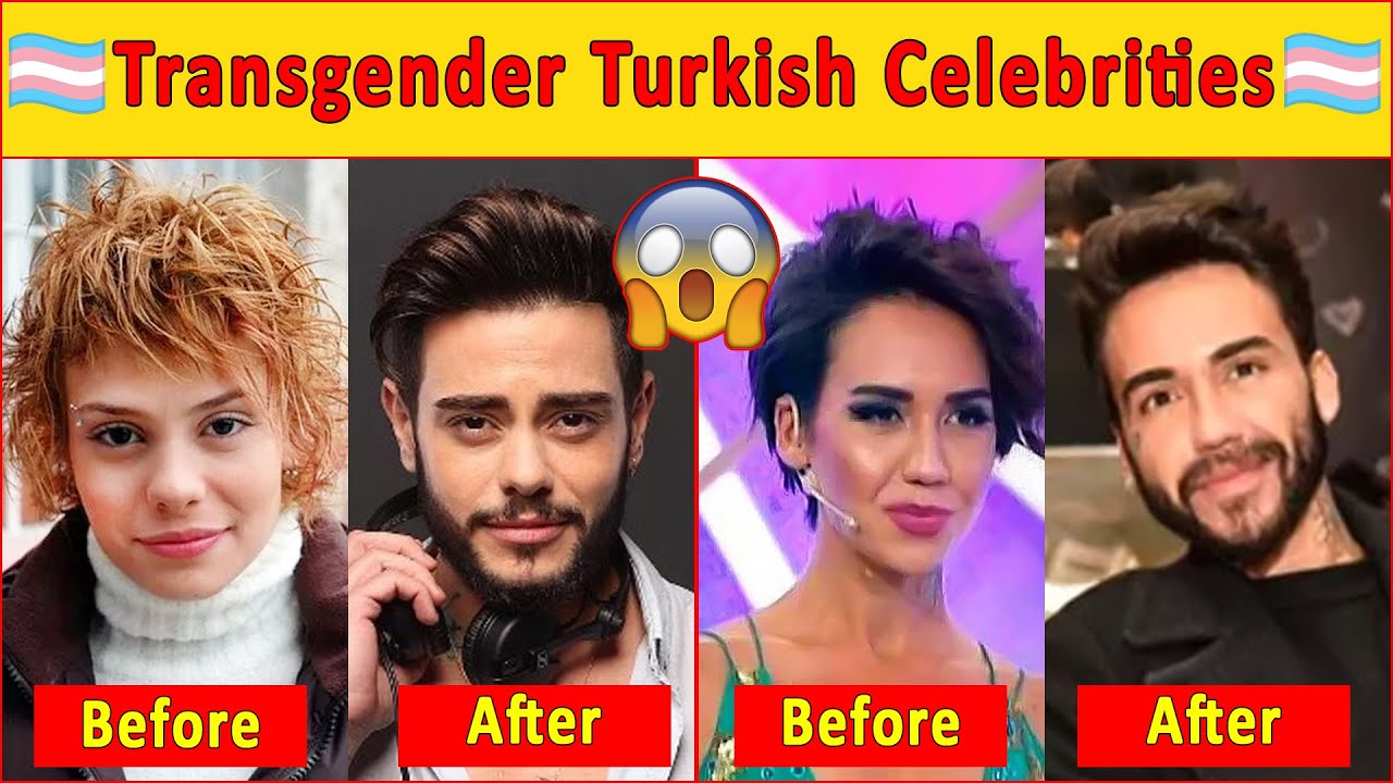 The Incredible Life story of Transgender Turkish Celebs😱Turkish Drama ...