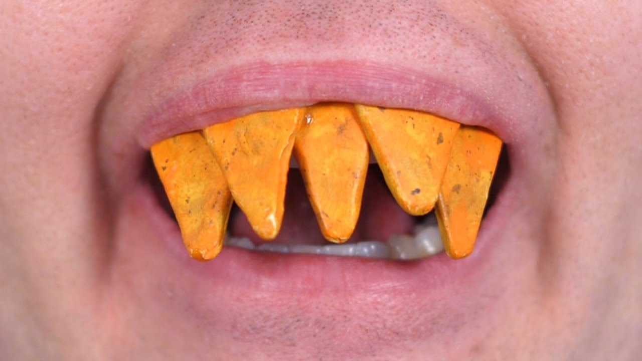 Teeth Made Of Doritos teeth-made-of-doritos