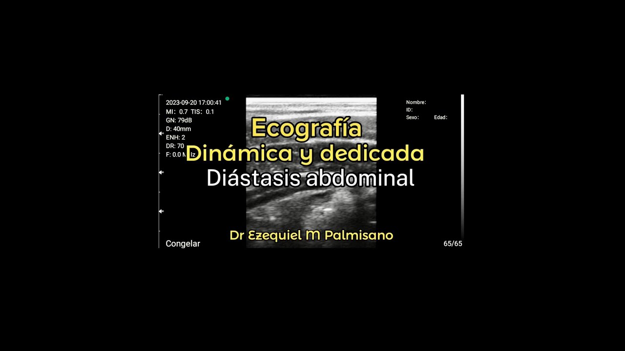 Ecografía dinámica y dedicada para la valoración funcional de la ...