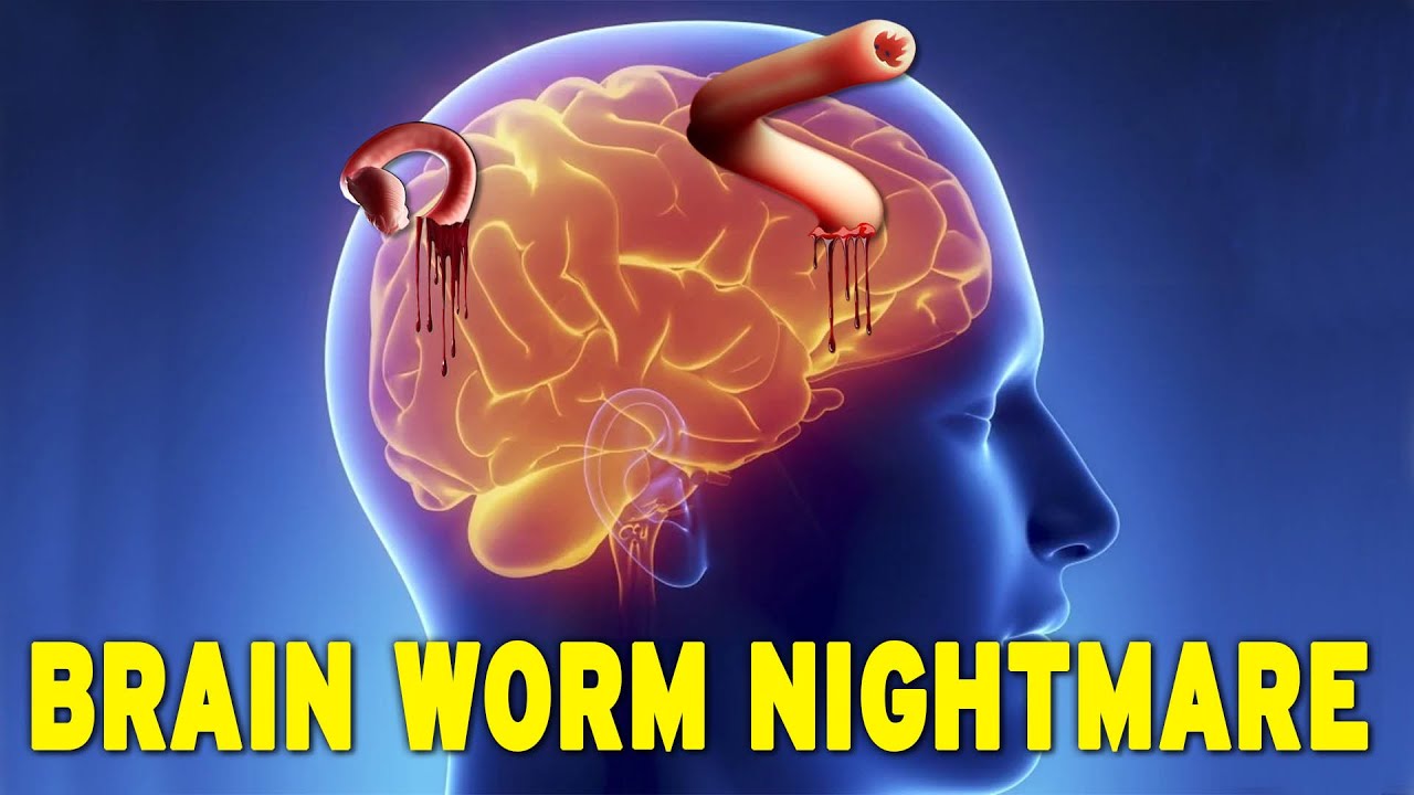 Brain-Worm Nightmare: Snake Parasite Found Inside Woman's Skull - YouTube