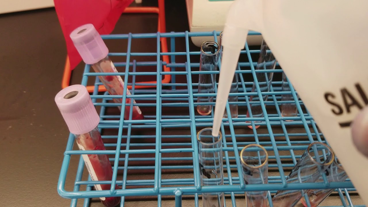 Blood Banking: Antibody Screen Part 3 - YouTube