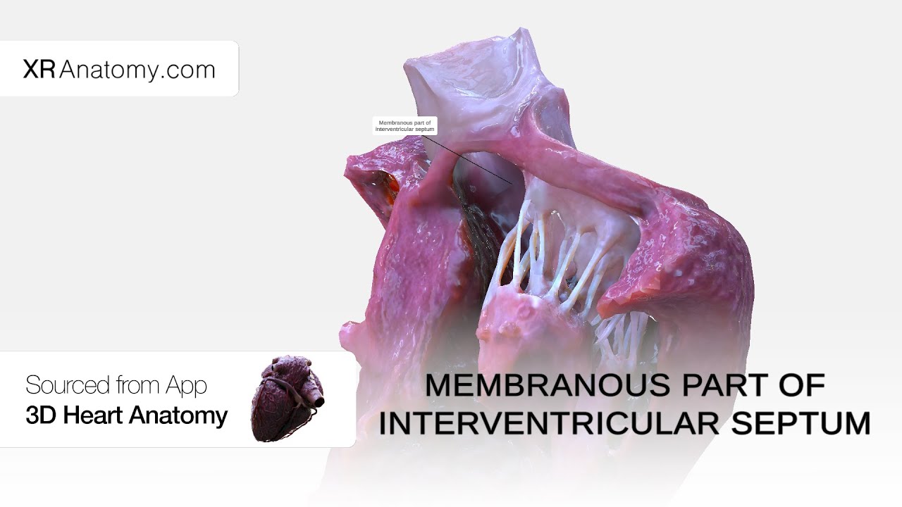 Membranous part of interventricular septum - YouTube