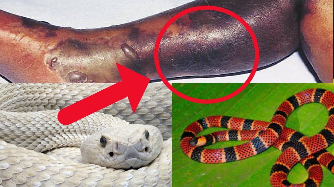 😱LAS "3" SERPIENTES MAS VENENOSAS DE MEXICO😱 - YouTube