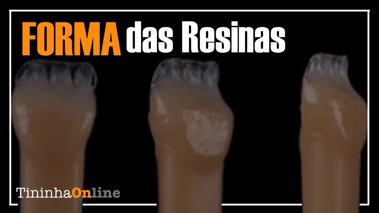 Forma das Restaurações com Resinas - YouTube