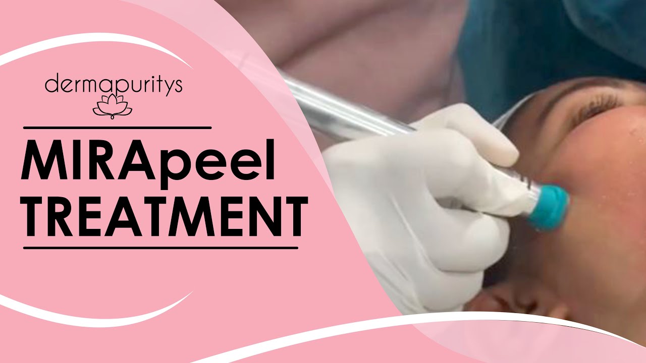 DermaPuritys | MIRApeel Treatment - YouTube