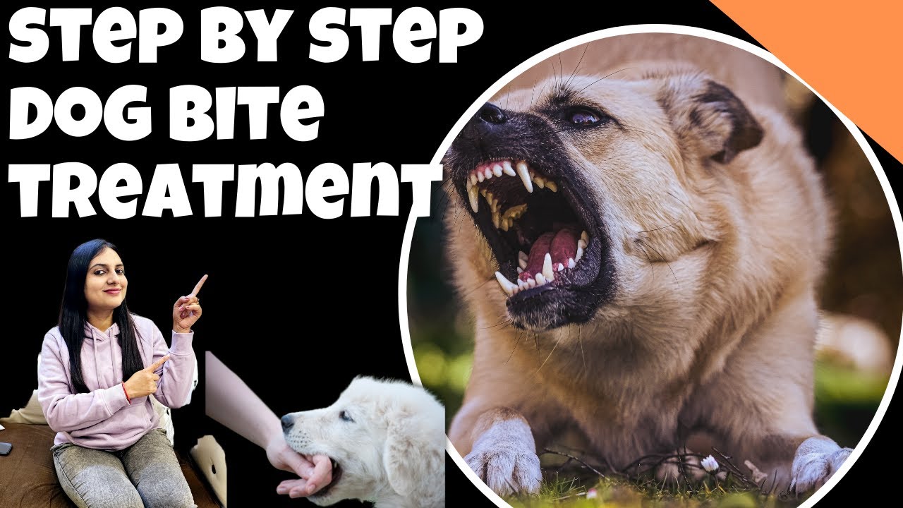 Step By Step Dog Bite Treatment | Your Guide For The Best Dog Bite ...