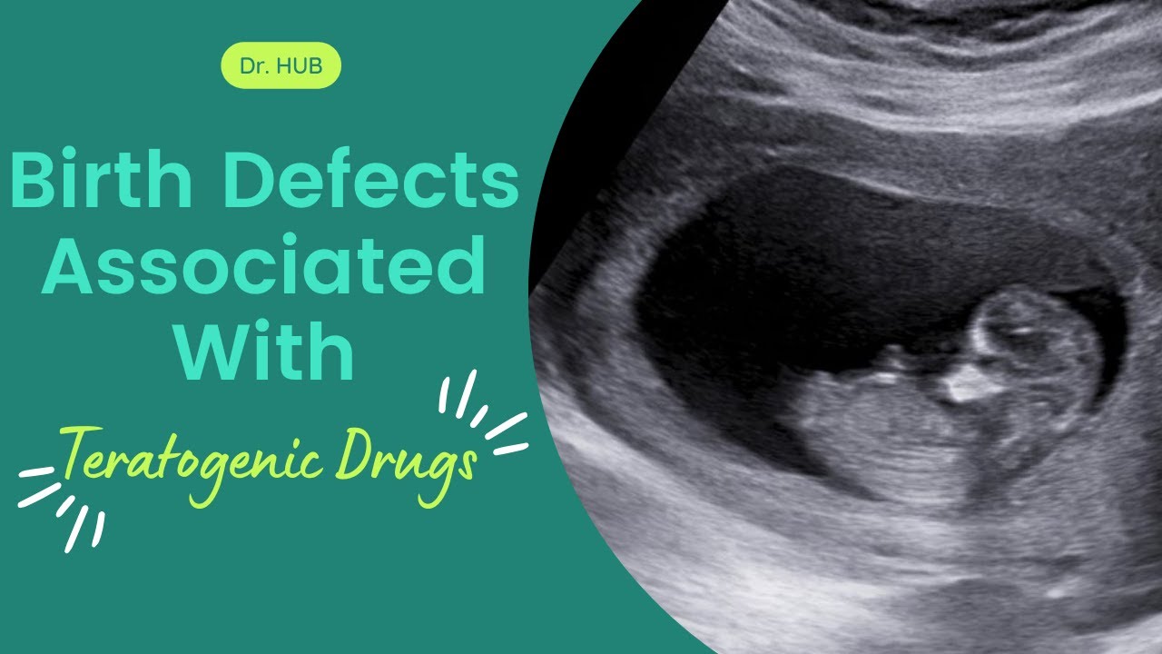 Birth Defects Associated With Teratogenic Drugs - YouTube