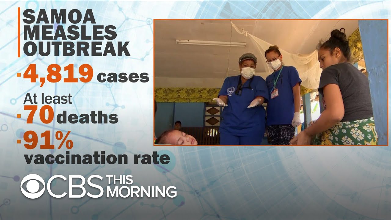 Samoan father loses 3 of his 5 children to measles outbreak - YouTube