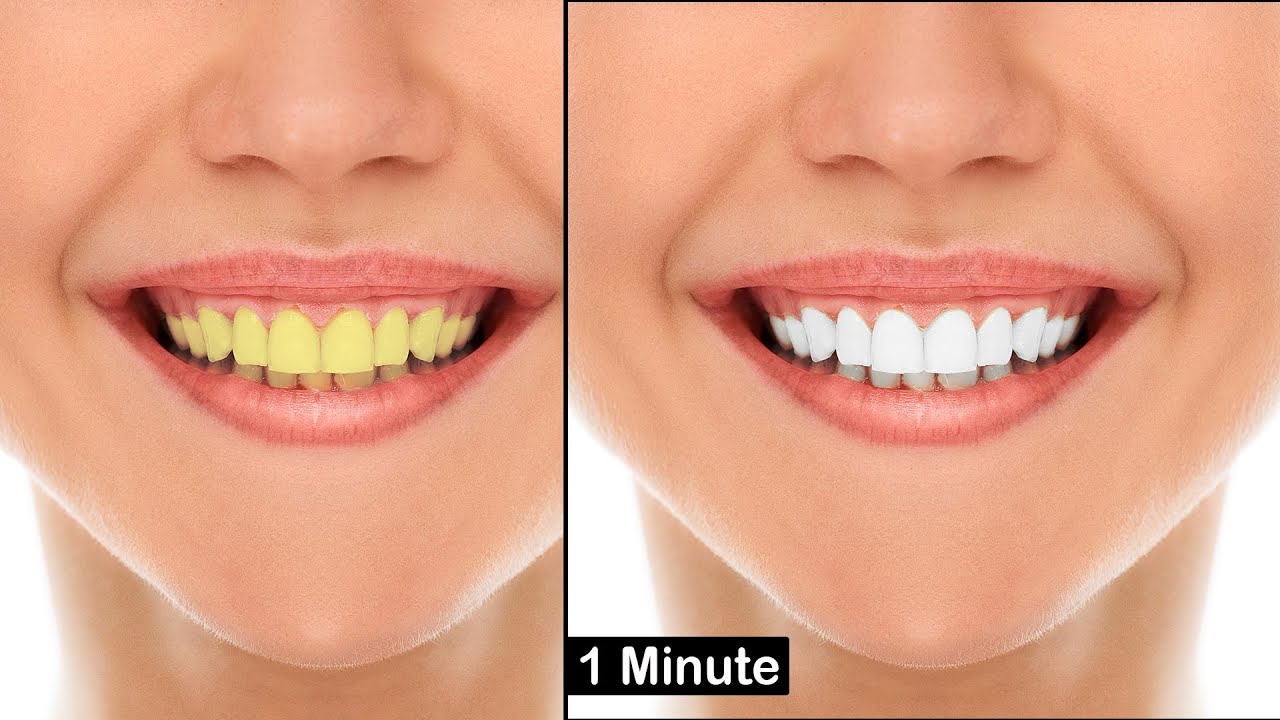 How to Change Teeth Color in Photoshop | Easy Tutorial - Photoshop ...