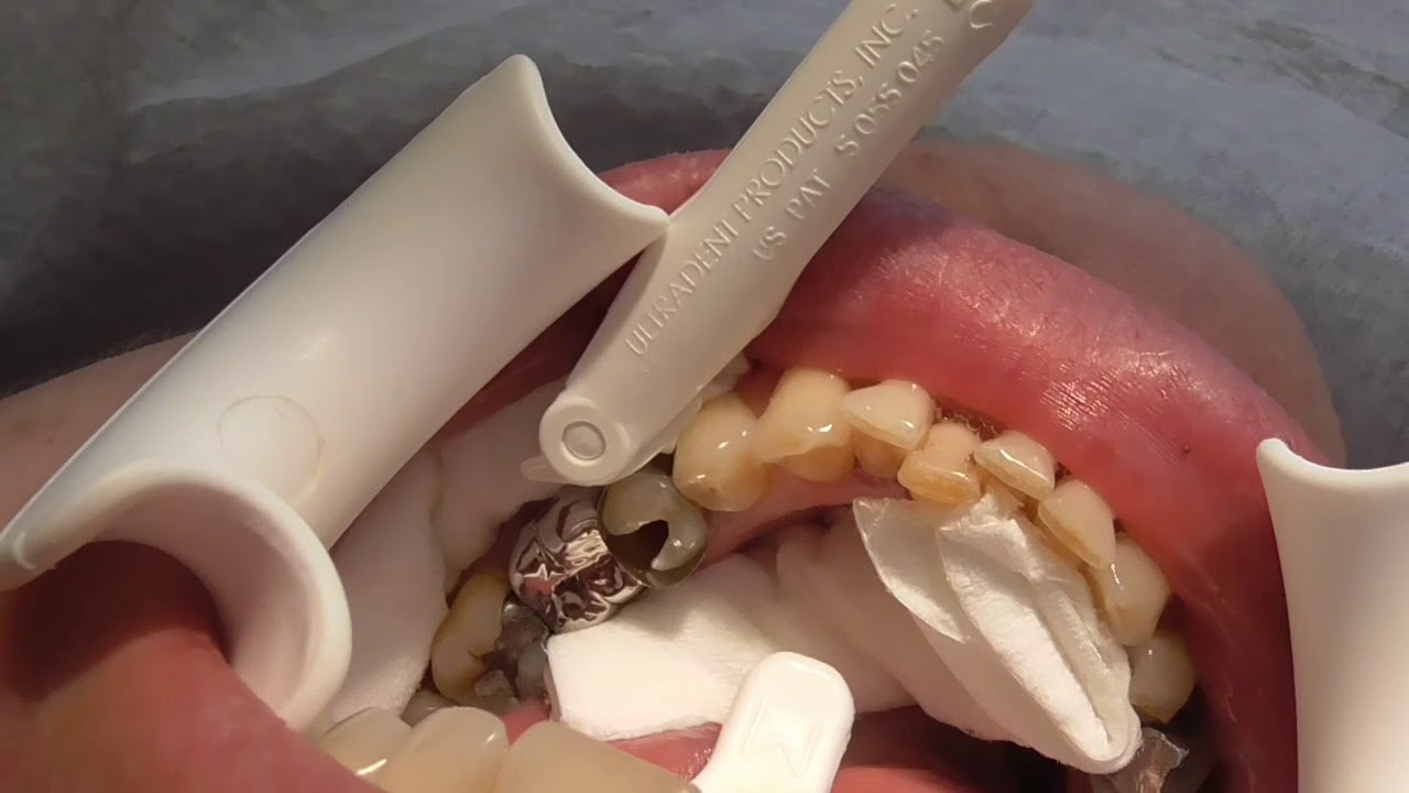 Omni-Matrix - matrice pro snadné použití ve všech kvadrantech - YouTube