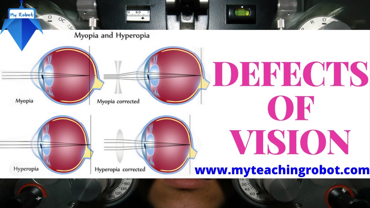 Eye defects and vision - YouTube