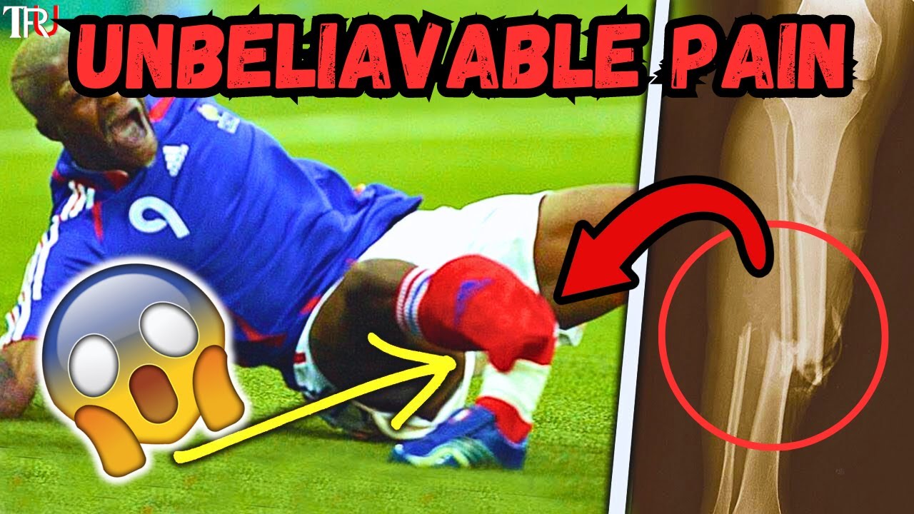 Soccer's Most Gruesome Injuries Unveiled: From Triumph to Tragedy - YouTube