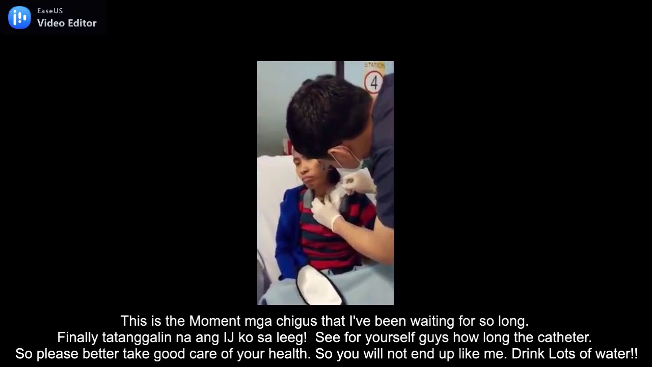 IJ Catheter Suture and Removal - YouTube