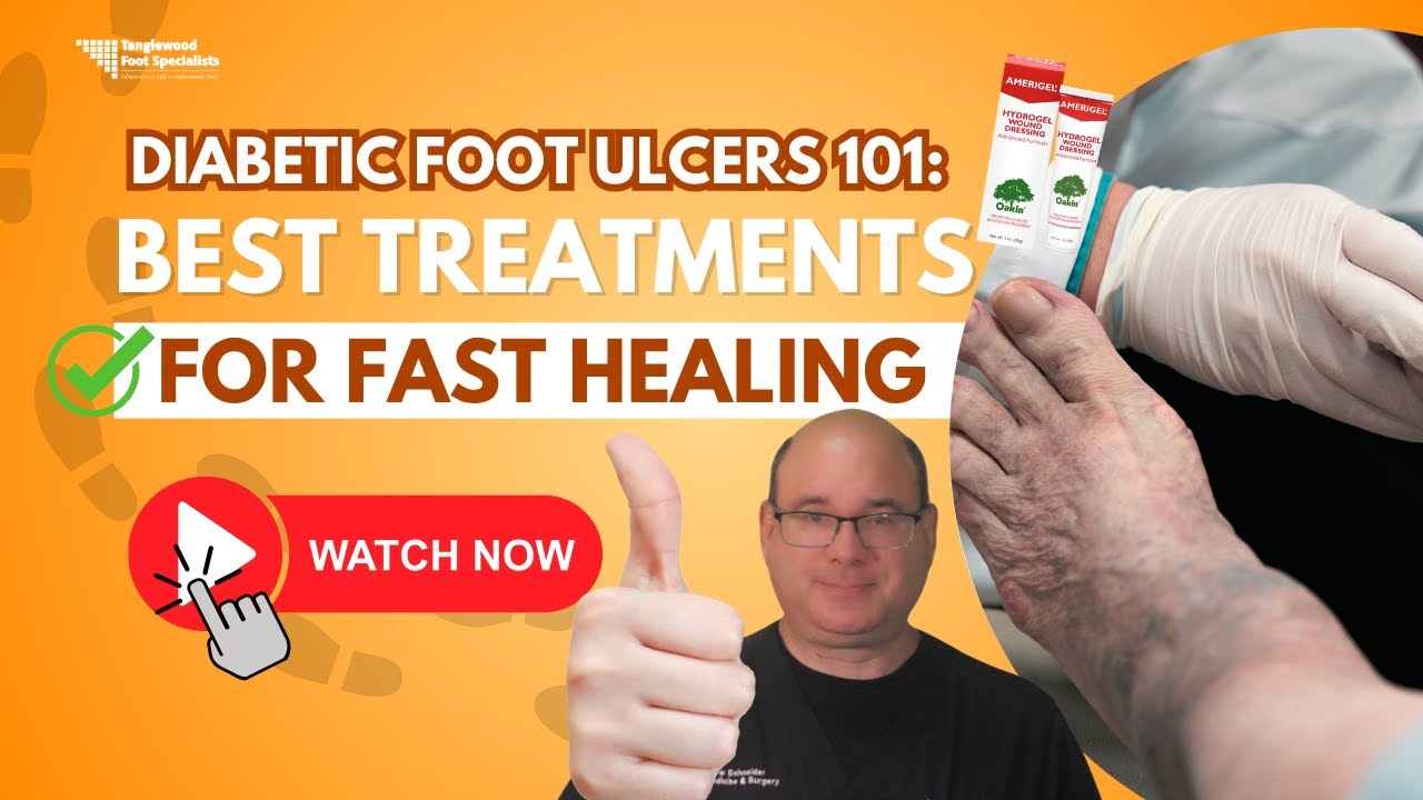 Diabetic Foot Ulcers 101: Best Treatments for Fast Healing - YouTube