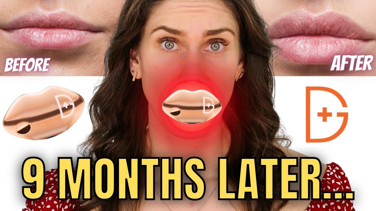 LED Plump Lips without Filler? Testing Dr. Dennis Gross LED Lip ...