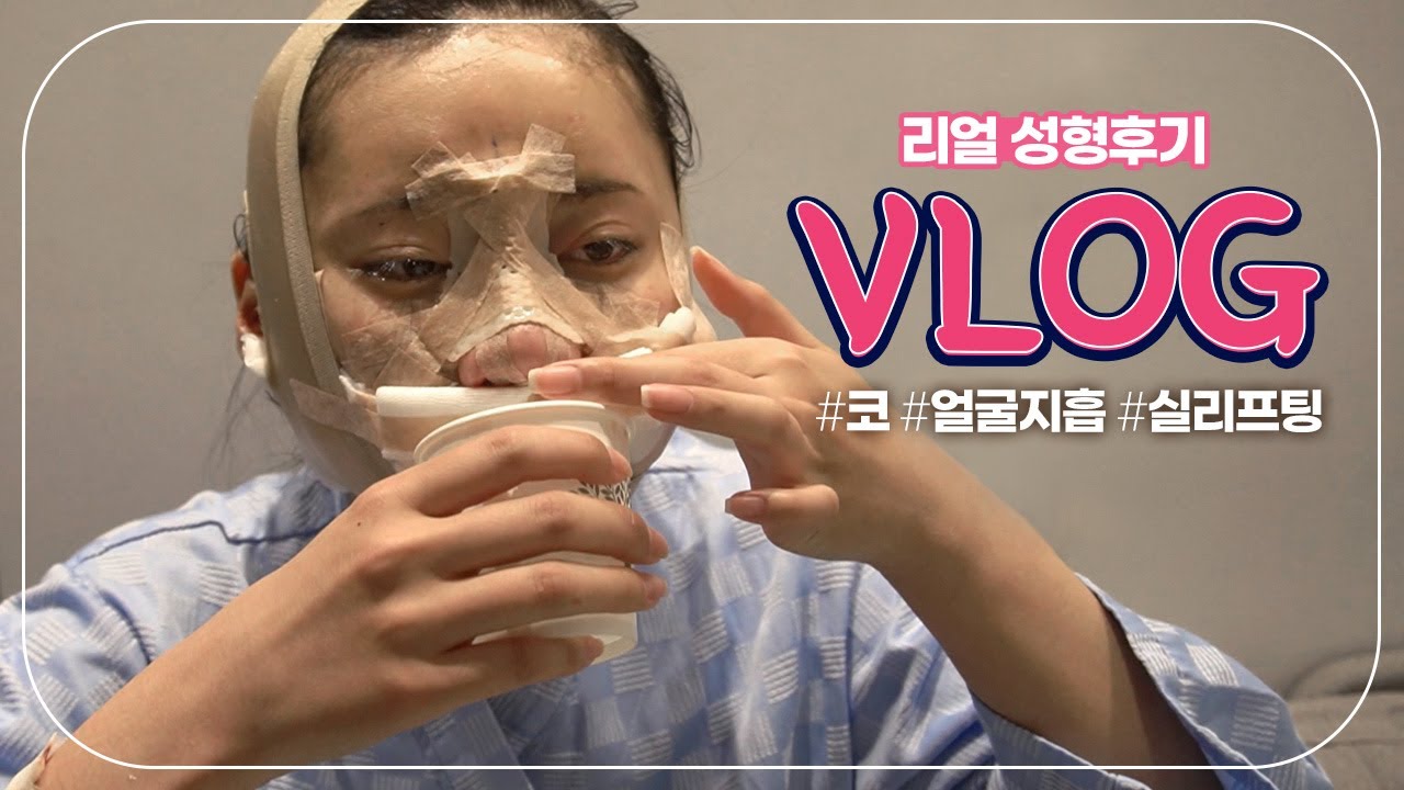 ์ฑํ Vlog ๐์ฝ ์ผ๊ตด์งํก ์ค๋ฆฌํํ
๐ ํ๋ฌ ์ฐจ ํ๊ธฐ์์๊น์ง๐ ๋ณต์ฝ์์ ๋ณต์ฝ์ฑํ์ฝ์์ ํ๊ธฐ์ฝ์ฑํํ๊ธฐ์ผ๊ตด์งํก์ ํ์ฝ