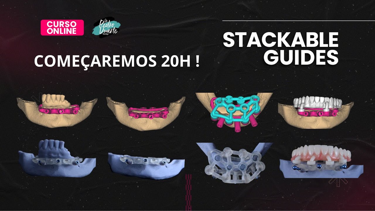 STACKABLE GUIDE ! - YouTube