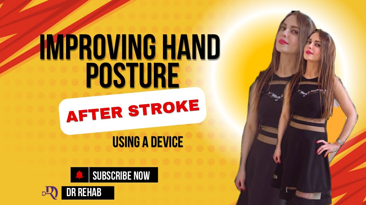 💖Improving Hand Posture After Stroke Using a Device - YouTube