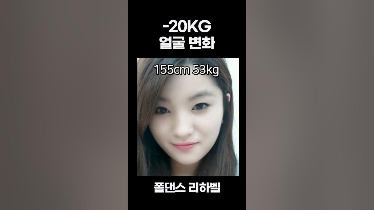 63kg 비만에서 -20KG 빠지는 과정 / 다이어트 전후 얼굴비교 #shorts - YouTube