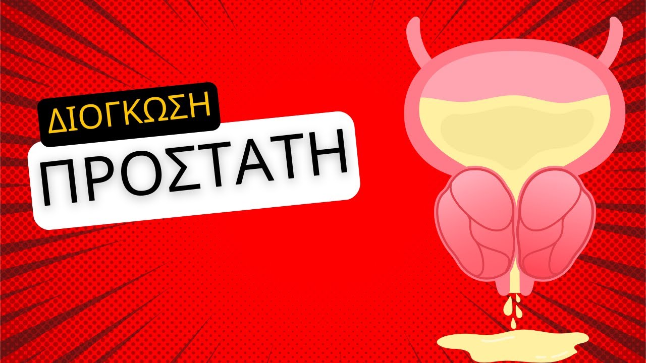 Πως να ανακουφιστείς από την διόγκωση προστάτη! - YouTube