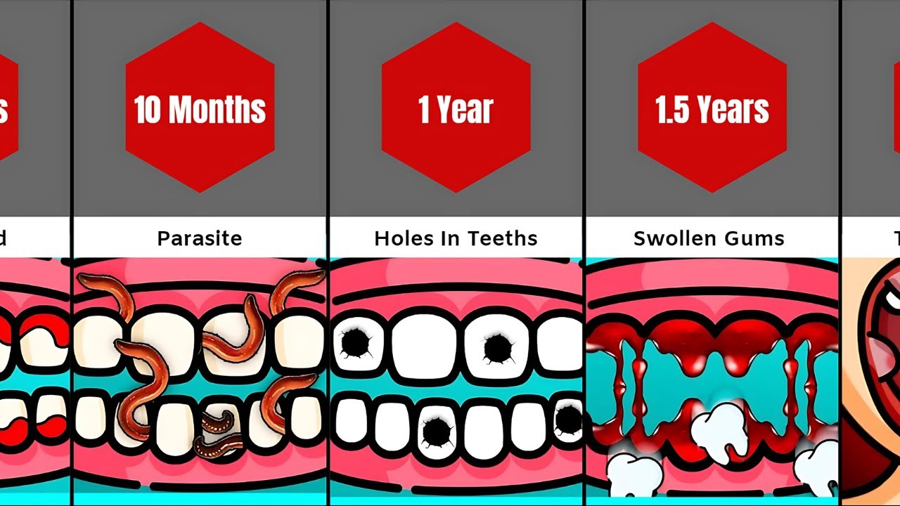 Timeline: What Happens If You Never Brush Your Teeth ? - YouTube