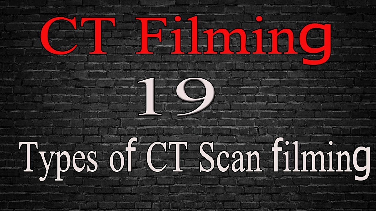 CT scan all filming - YouTube
