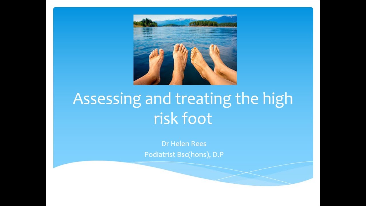 Assessing and Treating the High Risk Foot - YouTube