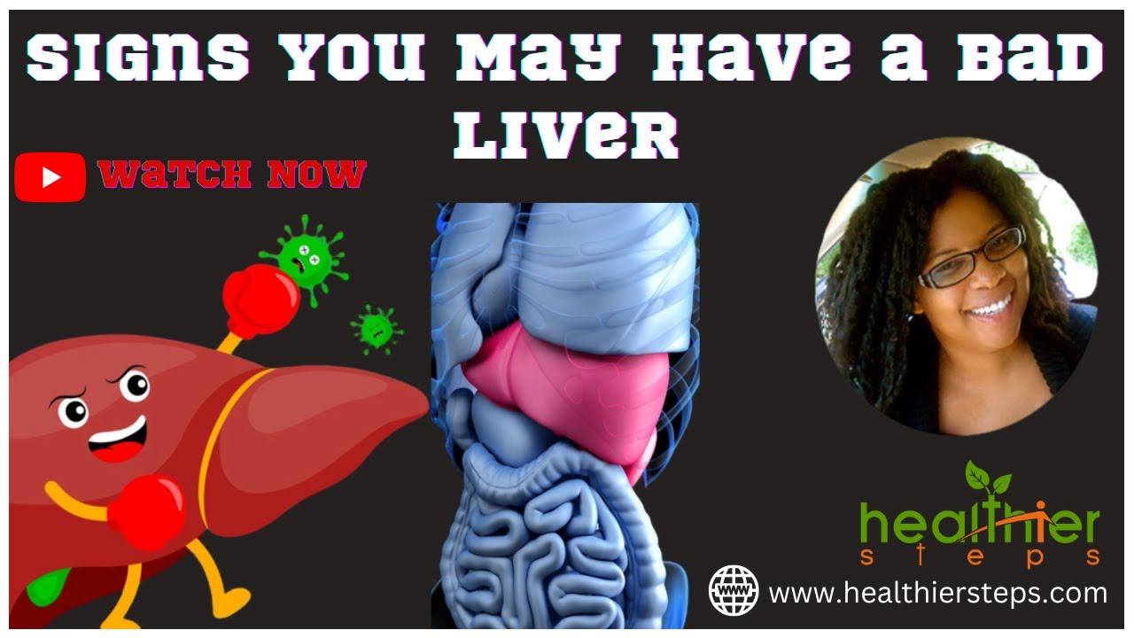 Signs You May Have a Bad Liver - YouTube