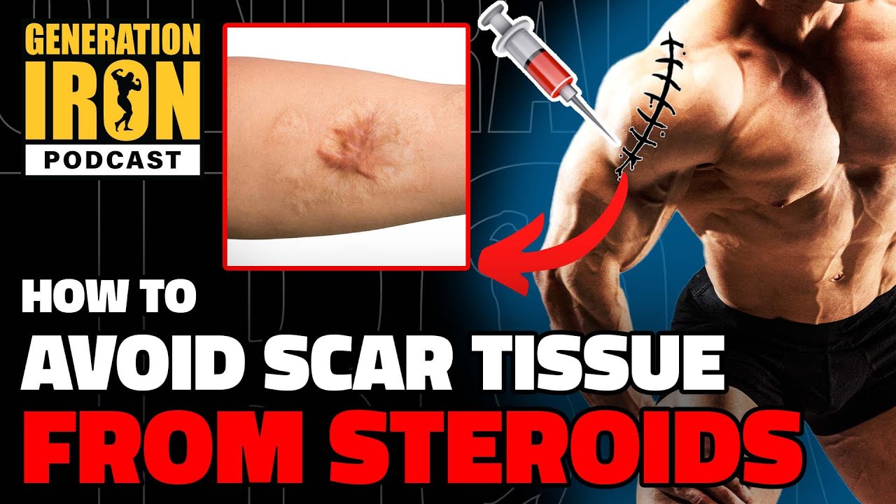 Muscle Scar Tissue