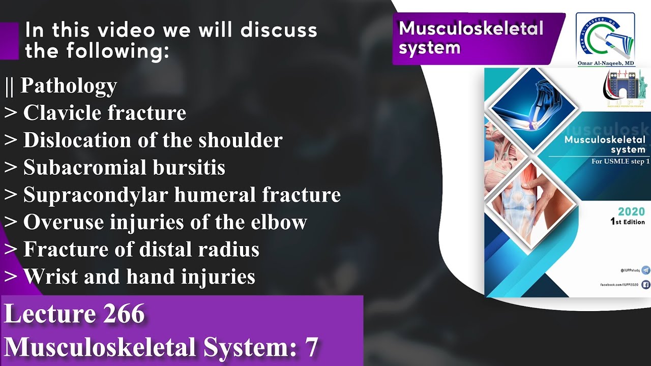 Clavicle fracture | Tennis elbow | Colles’ fracture | Carpal tunnel ...