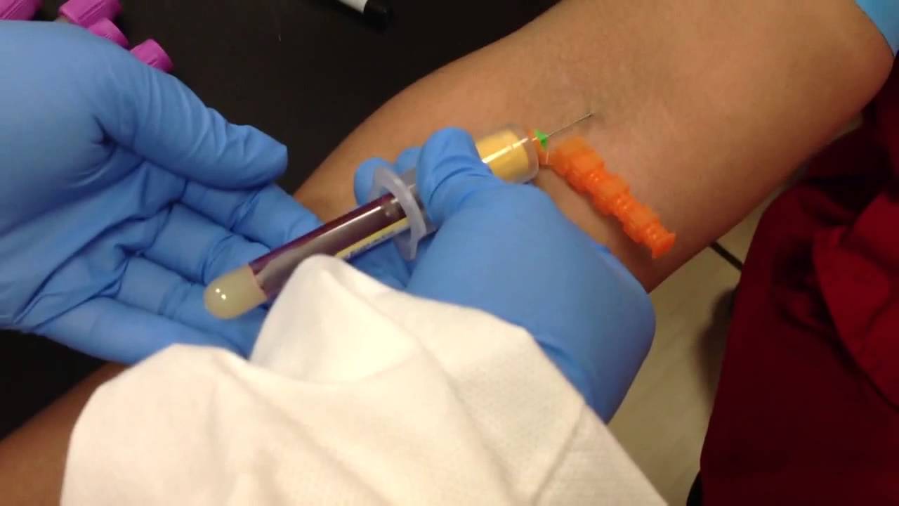 Venipuncture - YouTube