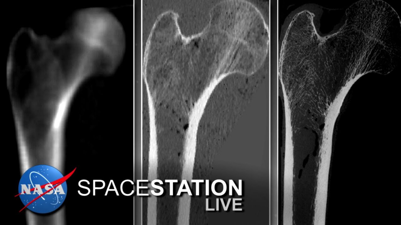 Space Station Live: A New Measure of Bone Strength - YouTube