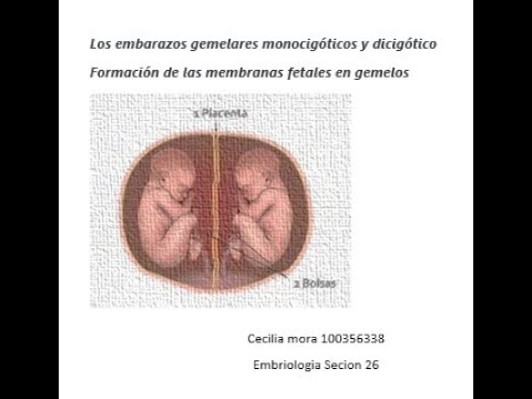 Embriologia; Embarazos gemelares monocigóticos y dicigóticos - YouTube