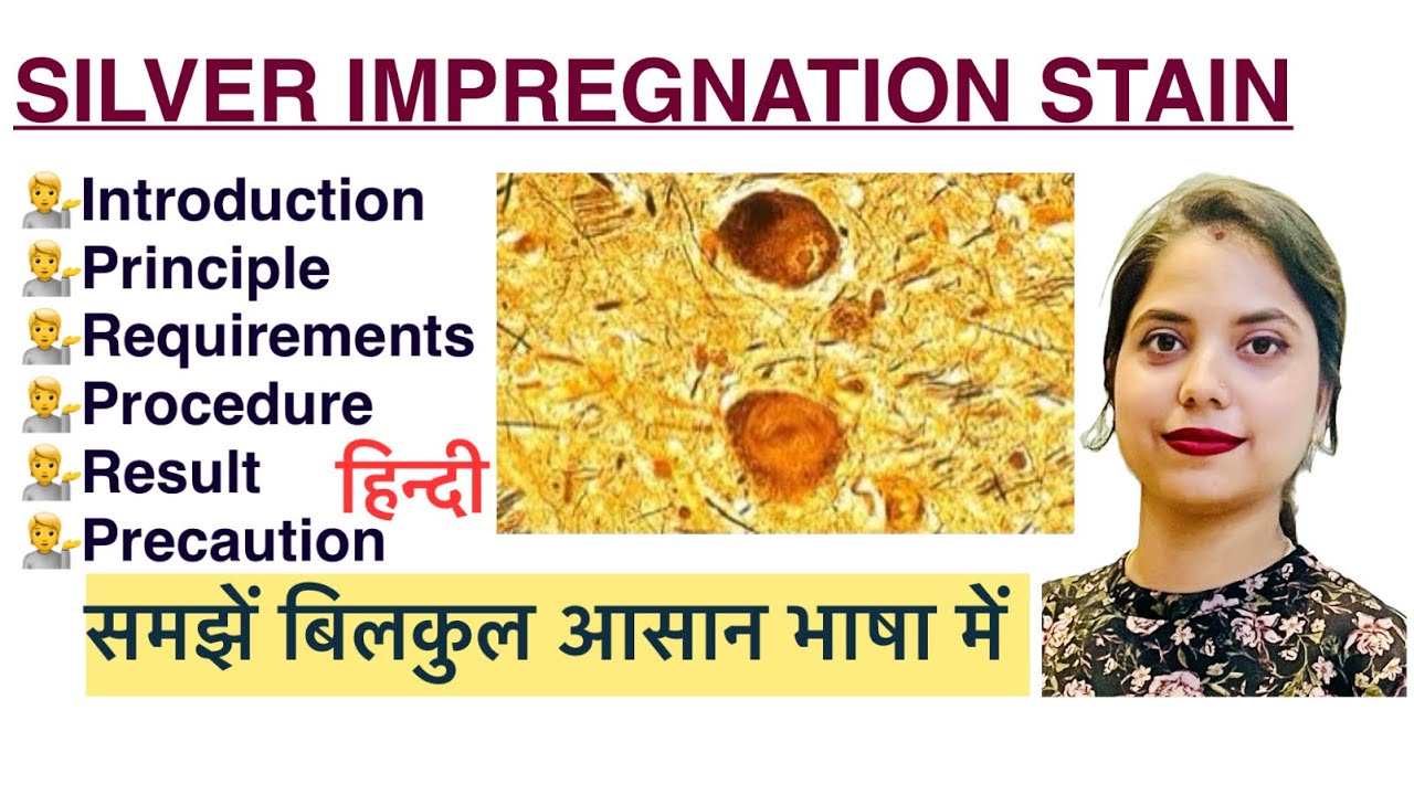 Silver impregnation stain in Hindi | Special Stain | Histopathology ...