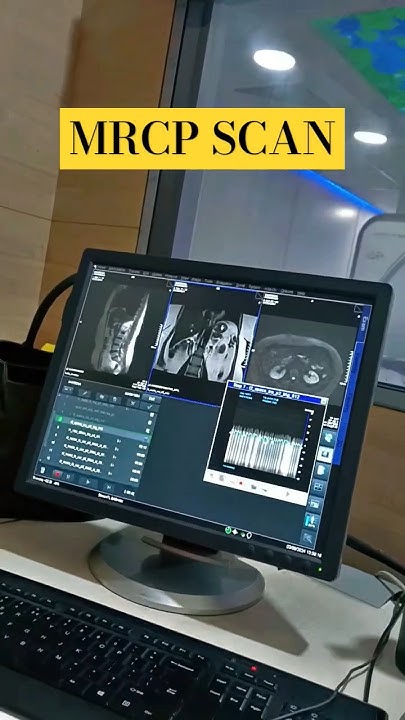 MRCP SCAN MRI #radiologycareer #viralshort#bscradiology#mriscan #trendingshorts#viral# ...